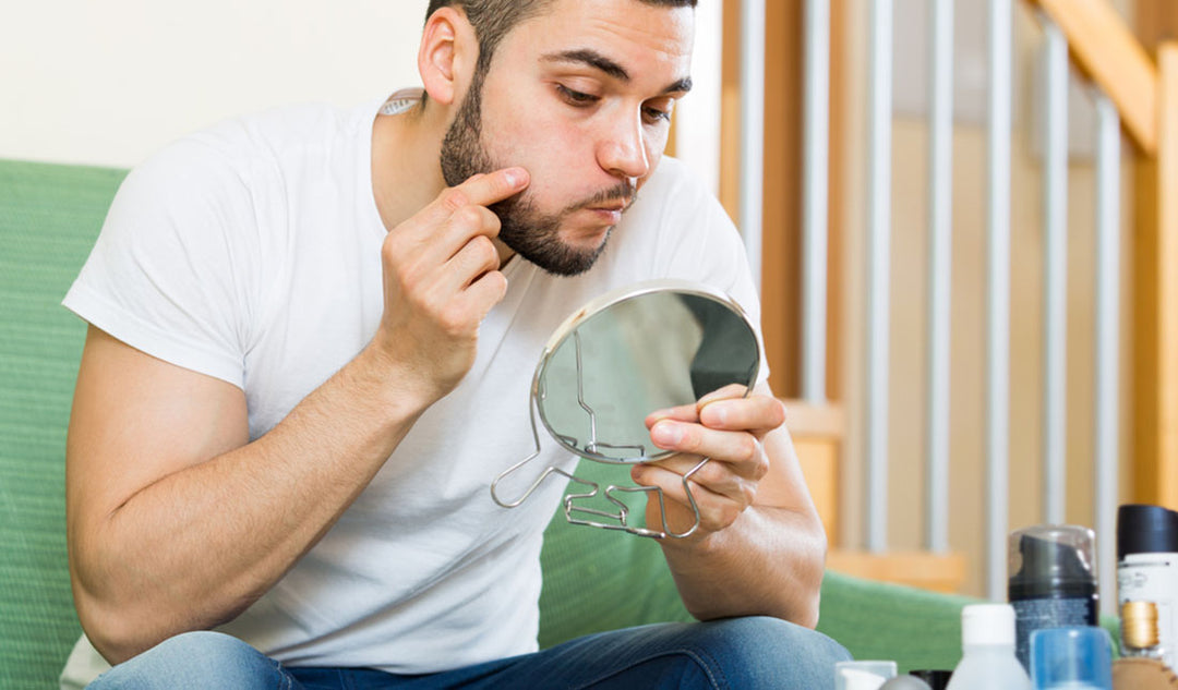 Comedonal Acne: Signs and How to Treat – Tiege Hanley