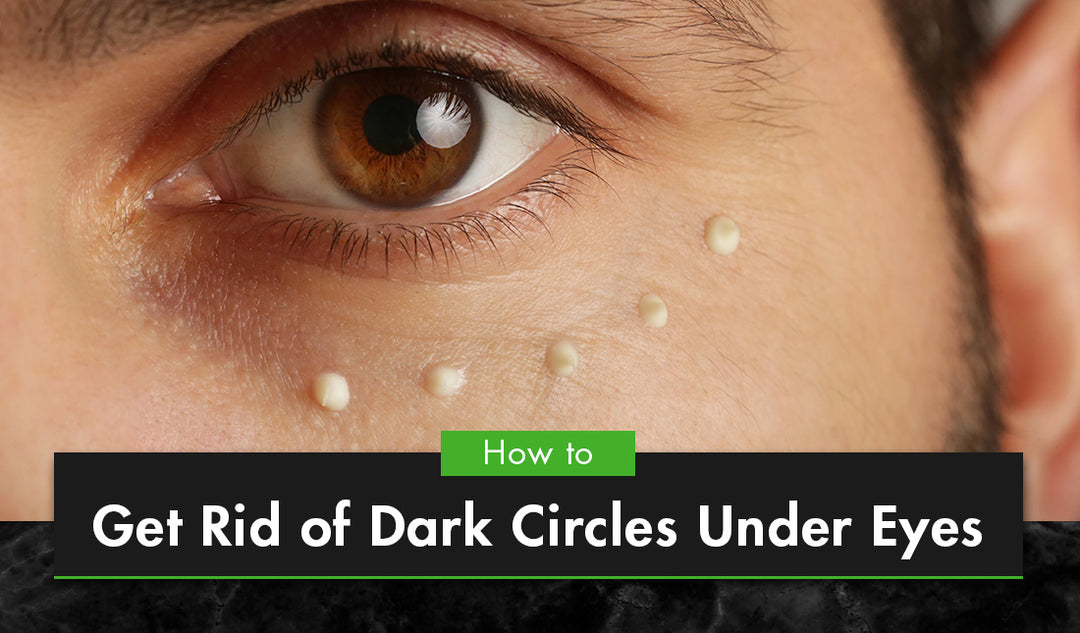 How to Get Rid of Dark Circles Under Eyes – Tiege Hanley